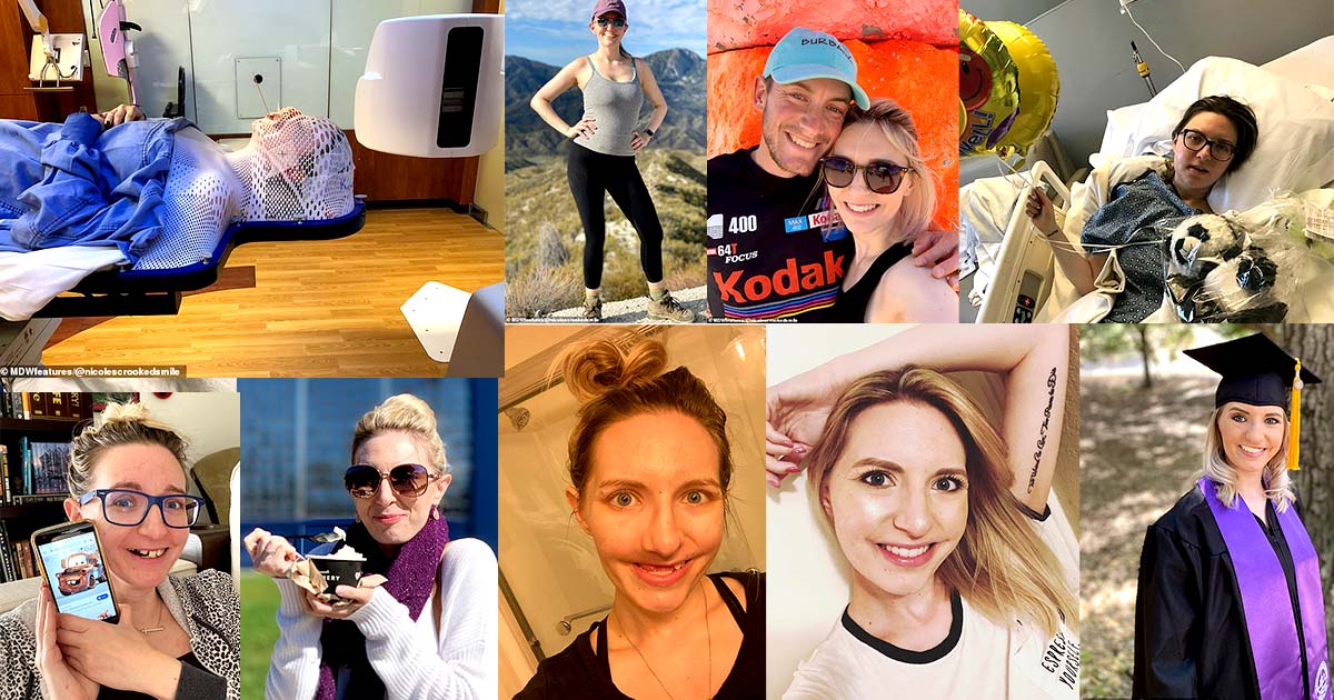 Nicole, 28, from California, found her toothache was actually a tumor ...